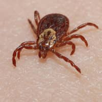 Deer Tick Bites And Symptoms